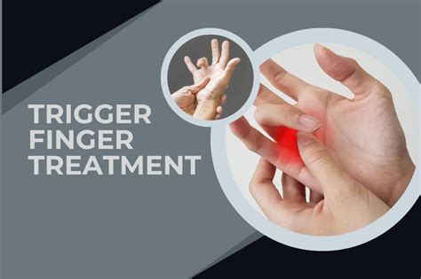 The Effects Of Trigger Finger Treatment The Run Time