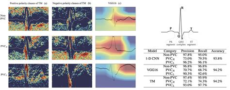 [r] Tsetlin Machine In Medical Research Striking Differences Between