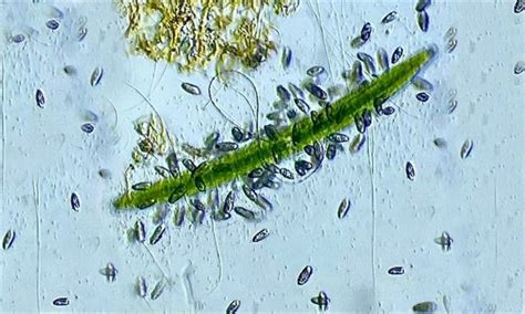 Closterium Sp Marine Biodiversity Portal Of Bangladesh