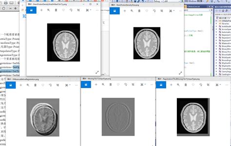 Itk 医学图像配准 知乎