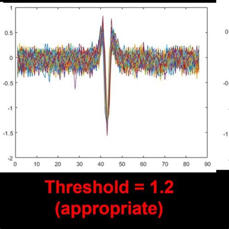 Effect On Single Pulse Signals With Different Thresholds Download Scientific Diagram