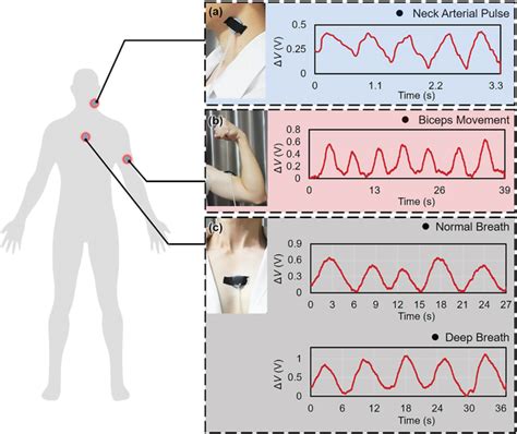 Application Of Llots In Real‐time Health Monitor Including A Neck Download Scientific Diagram