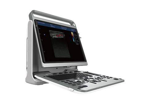 Msk Portable Ultrasound Scanner Machine With 18 Mhz High Frequency