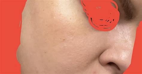 An Idea As To How The Nudestix Skin Tint Looks After 10 Hours All Day Wear Album On Imgur