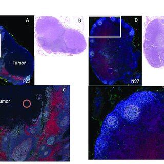 Example Of DSP Analysis We Used 2 Patients For DSP Analysis Patient Download Scientific