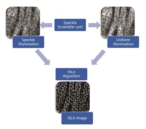 Best Of Both Worlds Combining Speckle Illumination And Slide Scanners For Fast Sharp Imaging