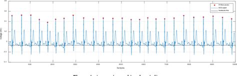 Figure 9 From Segmentation Of The Ecg Signal By Means Of A Linear