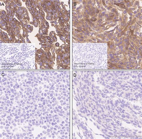 Anti Hla Class 1 Abcg Antibody Epr29051 62 Ab323616 Abcam
