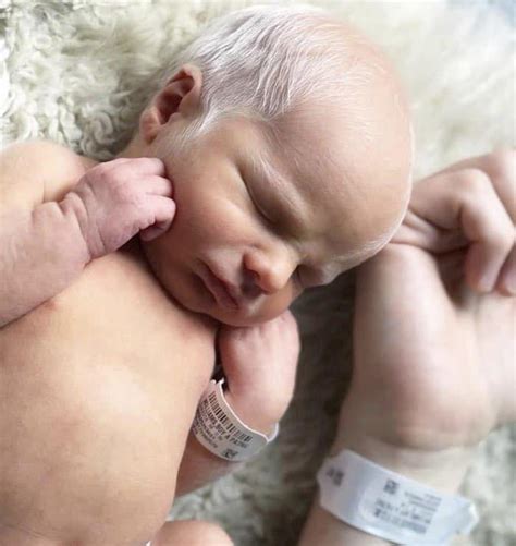 იყავი ბედნიერი ბავშვი მოხუცი კაცივით ნაცრისფერი თმით დაიბადა 😱 გავიდა 9 წელი გაოგნებული