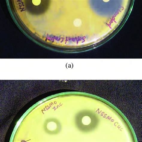 A Zone Of Inhibition For The Ligand Nssmo Against Staphylococcus