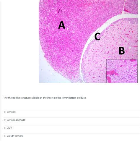 Solved The Thread Like Structures Visible On The