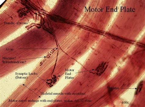 Neuromuscular Junction Dysfunction Flashcards Quizlet