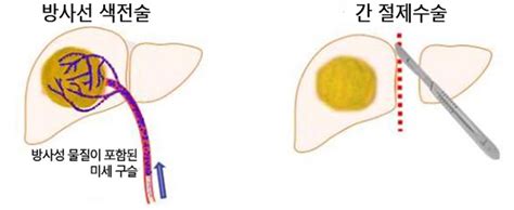 서울대학교병원