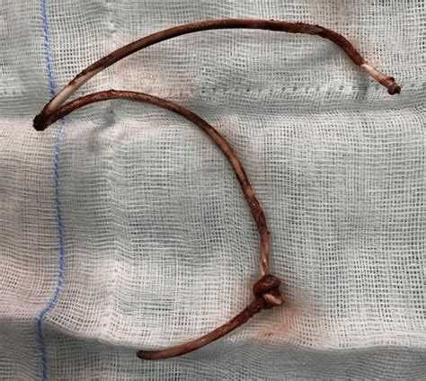 This Image Shows Ascending Urethrogram Image Of The Electric Wire