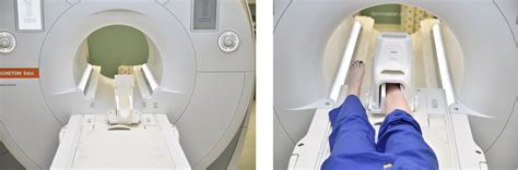 Peroneal Tendon Mri Protocol And Planning