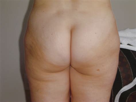 Wife Voyeured Porn Pictures Xxx Photos Sex Images Pictoa