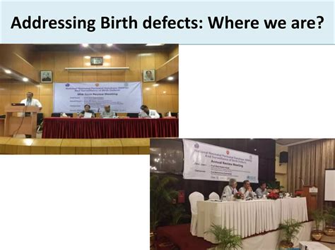 Seminar Birth Defect Ppt