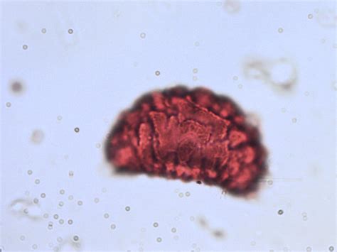 2212 1 Polypodium Vulgare Global Pollen Project Global Pollen