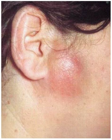 The Emergencies In The Group Of Patients With Temporomandibular Disorders