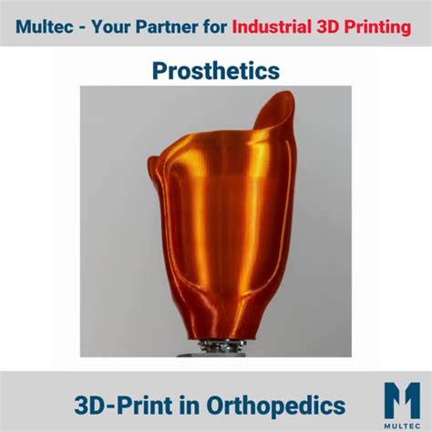 Multec Gmbh On Linkedin Orthopedics 3dprinting Innovation