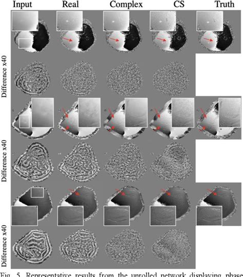 Figure 5 From Analysis Of Deep Complex Valued Convolutional Neural Networks For Mri