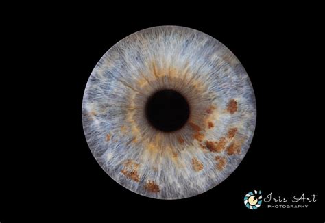 Iris Colours And Patterns