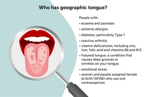 Geographic Tongue Images Free Download On Freepik