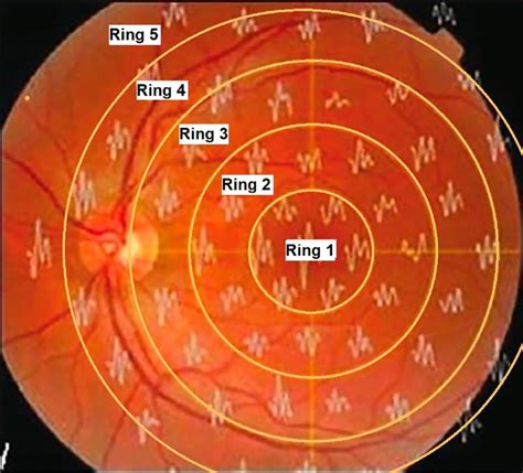 A Demonstrative Diagram Showing The Anatomic Location Of The 5 Rings Of Download Scientific