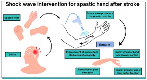 Extracorporeal Shockwave Treatment As Additional Therapy In Patients