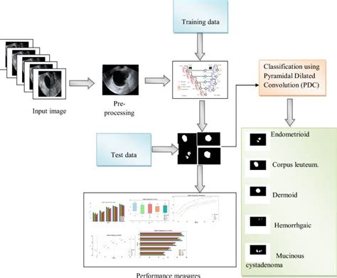 Segmentation Of Ovarian Cyst In Ultrasound Images Using Adaresu Net With Optimization Algorithm