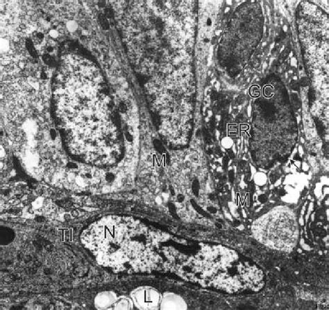 Enlarged Endoplasmic Reticulum Er Cisternae And Perinuclear Cisternae Download Scientific