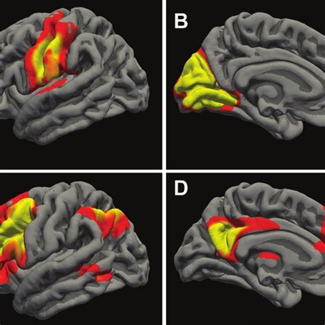 Construction Of A Functional Brain Network Functional Mri Fmri Download Scientific Diagram