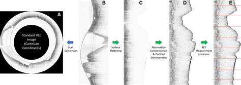 Graphical Overview Of The Contrast Enhancement Algorithm A Standard