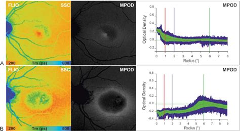 Comparison Of Mpod Profiles Obtained Using 2 Wavelength Faf In Two Download Scientific Diagram