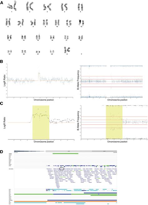 Single Nucleotide Polymorphism Snp Arrays And Their Sensitivity For
