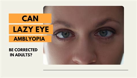 Lazy Eye