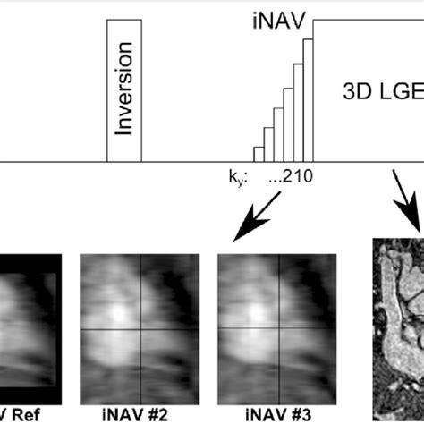 Pulse Sequence Diagram Of Image Navigated Inav 3d Late Gadolinium