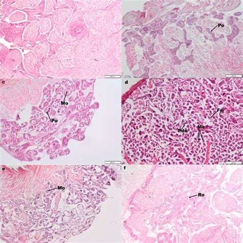 Photomicrographs Showing Reproductive Maturity Stages Of Donax