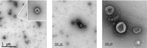 Smartsec Delipo™ Advanced Sev Isolation Kit System Biosciences
