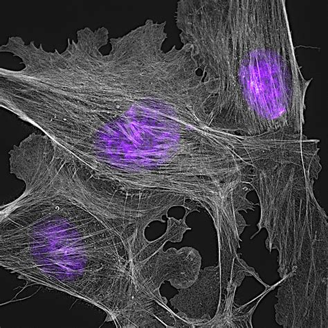 Actin Cytoskeleton Of Bovine Pulmonary Epithelial Cells Nikon Small World