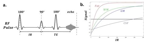 10 A A Spin Echo Sequence With Inversion Preparation Pulse B Download Scientific Diagram