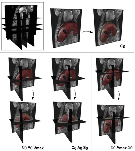 Figure 3 From 3d Physics Based Registration Of 2d Dynamic Mri Data Semantic Scholar