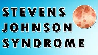Steven Johnson Syndrome Early Stages