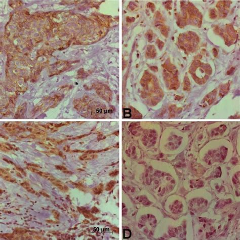 Different Morphological Structures Of Breast Tumors A Tumor Section Download Scientific