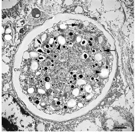 Liver Single Algal Organism Showing A Thick Cell Wall Cw Large Download Scientific Diagram