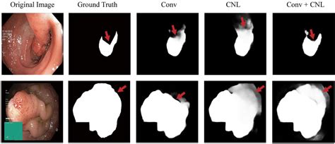 Qualitative Comparison Of Segmentation Results By Different Branches In Download Scientific