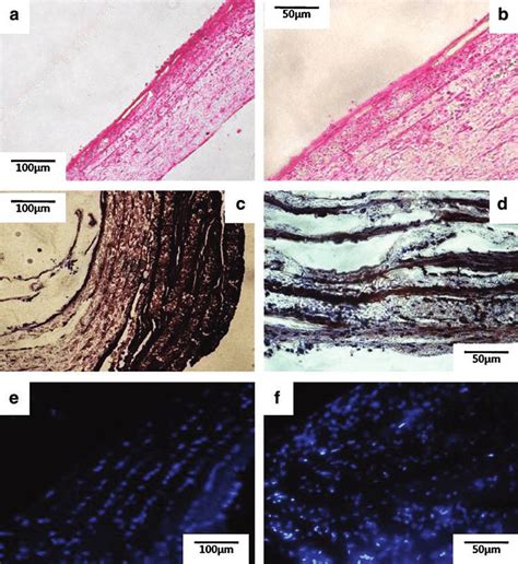 Histological Evaluation Of A Small Diameter Vascular Graft Using Cell Download Scientific