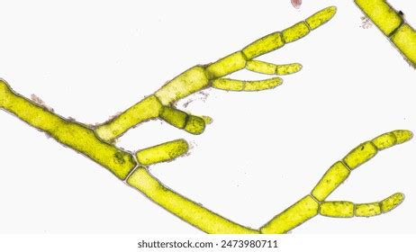 Marine Green Algae Under Microscope Species Stock Photo Shutterstock