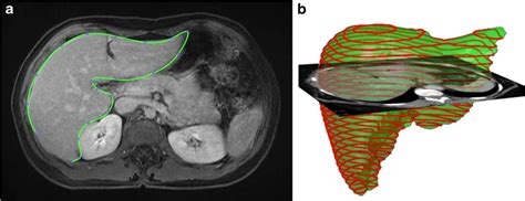 Manual Segmentation Of The Liver A Manual Segmentation Of The Liver Download Scientific