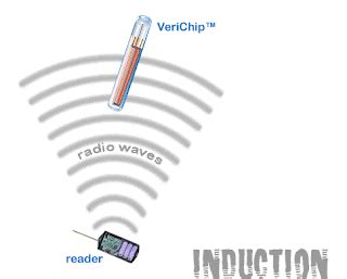 All About Life Microchip To Be Implanted In Humans In